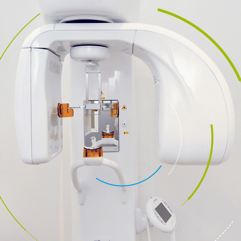 Cone Beam : quel fabricant pour quelle machine ? | Synergie Dentaire